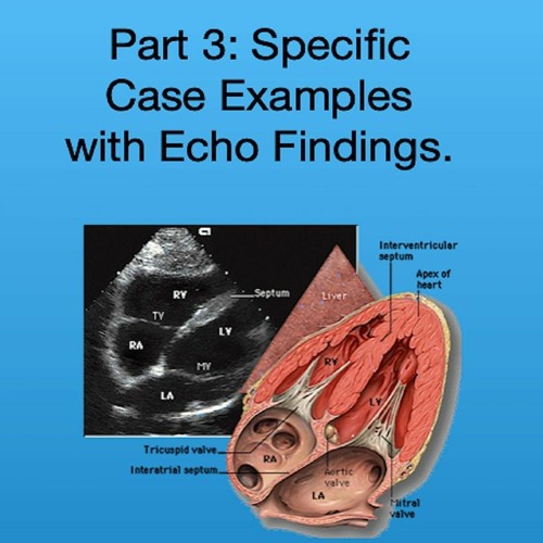 Stream episode (PDF BOOK) Echocardiograms - Part 3: Specific Case ...