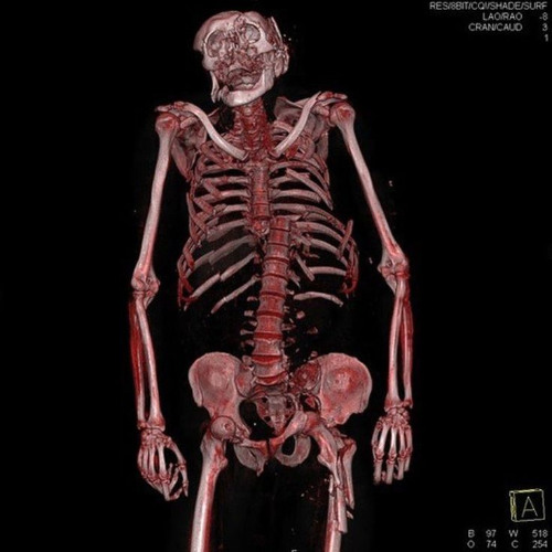 Stream [free] necrotrap x torturecore type beat - goregrind [prod ...