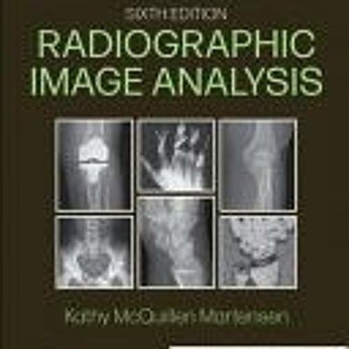 Stream (PDF) Radiographic Image Analysis - Kathy McQuillen Martensen MA ...