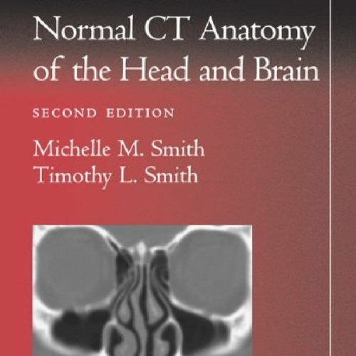 Stream download PDF Pocket Atlas of Normal CT Anatomy of the Head and ...