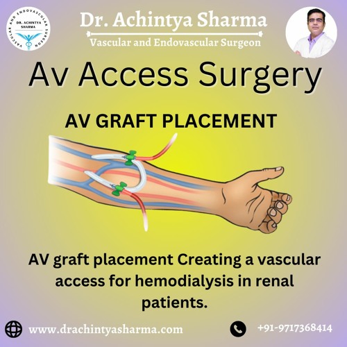 Stream An overview of AV Access Surgery, including types, procedures ...