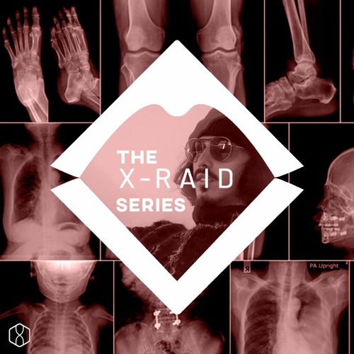 HeyDoc! - X-RAID Series #01 2023-07-11