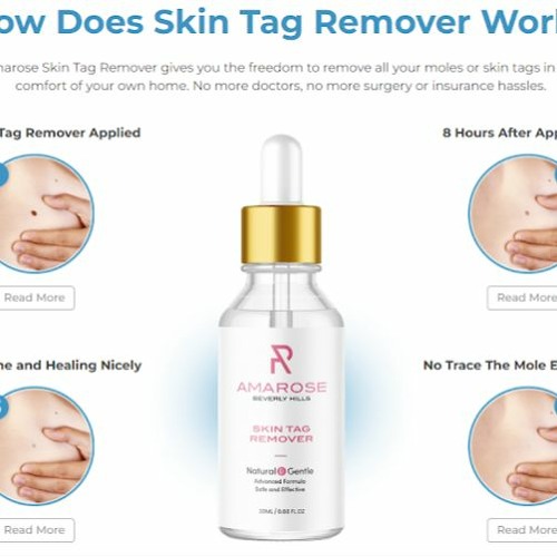 Stream Amarose Skin Tag Remover Amazon – Know This Before Buying! by ... Stream Amarose Skin Tag Remover Amazon – Know This Before Buying! by ...