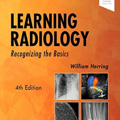 Stream PDF Download Learning Radiology: Recognizing the Basics from ... Stream PDF Download Learning Radiology: Recognizing the Basics from ...