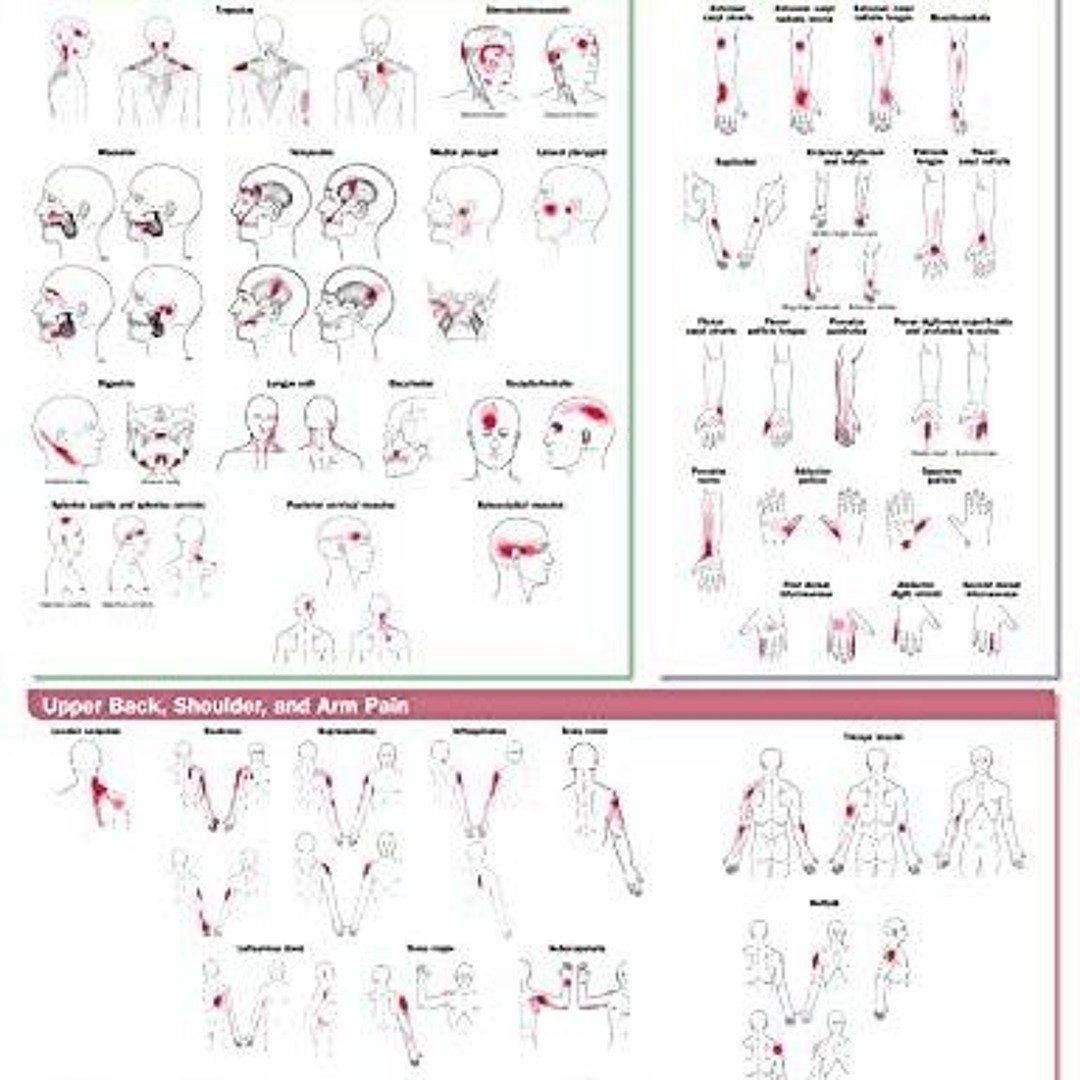 Stream episode READ [PDF] Travell, Simons & Simons? Trigger Point Pain ...