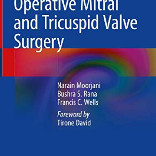 Stream [PDF] Operative Mitral and Tricuspid Valve Surgery by wertas ...