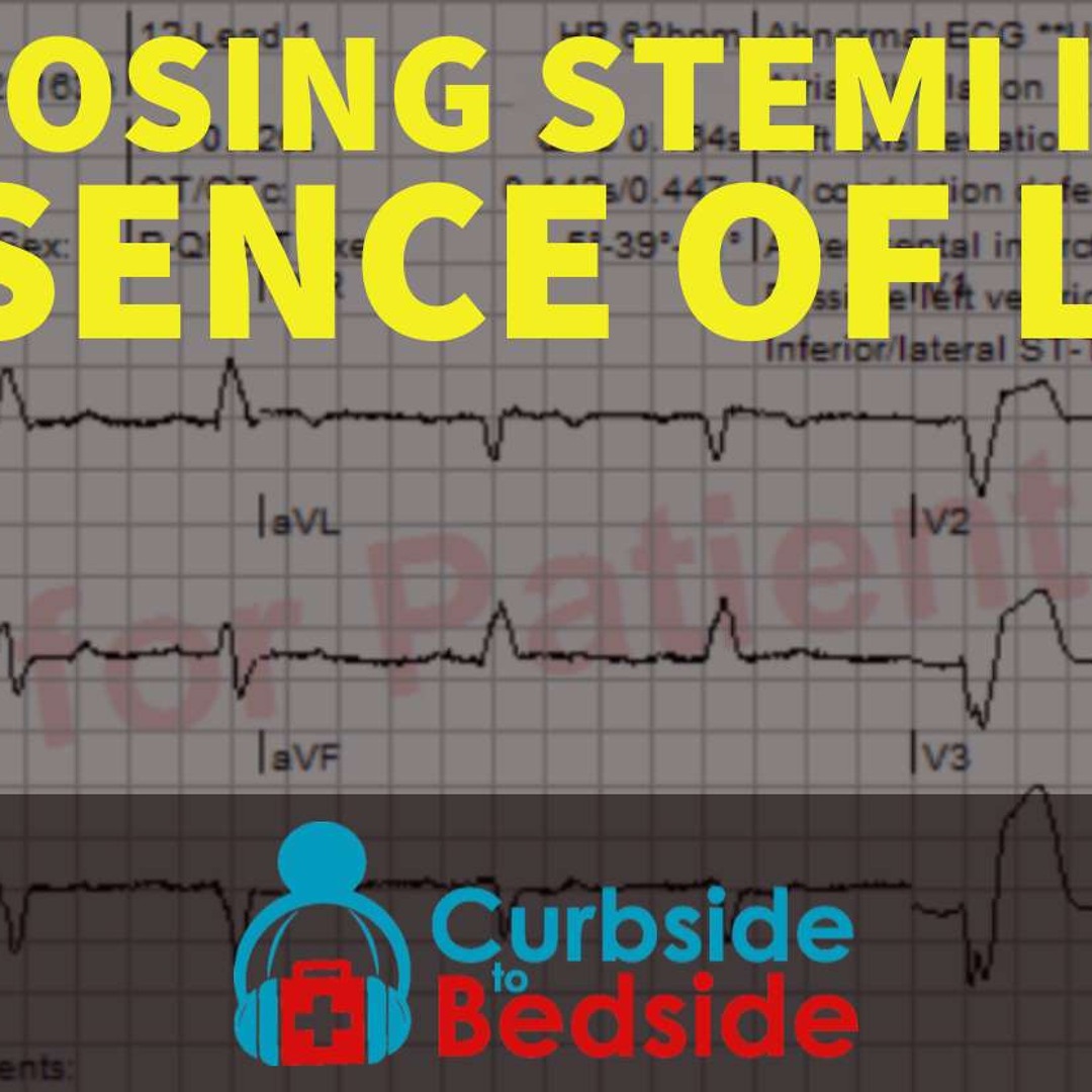Stream Diagnosing STEMI in Left Bundle Branch Block by Curbside to ...
