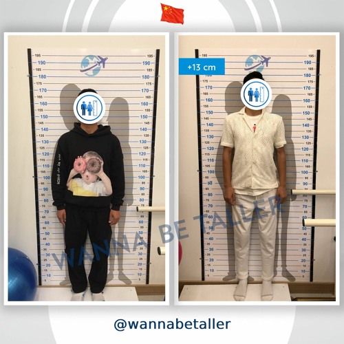 Stream episode The Long and Short - Limb Lengthening by Wanna Be Taller ...