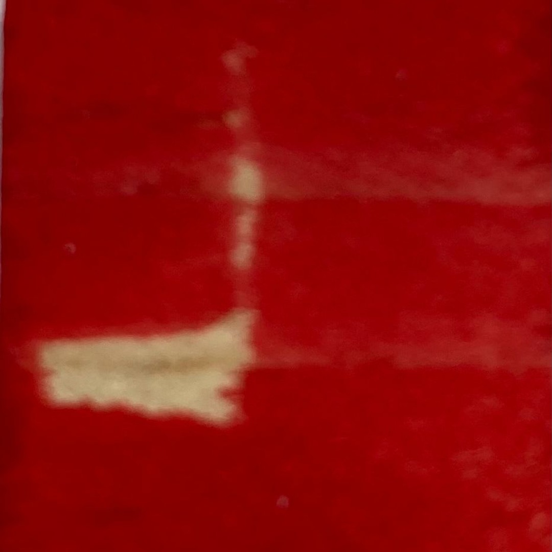 Stream Lateral tap flap alveolar(l) by Sophie T Lin | Listen online for ...