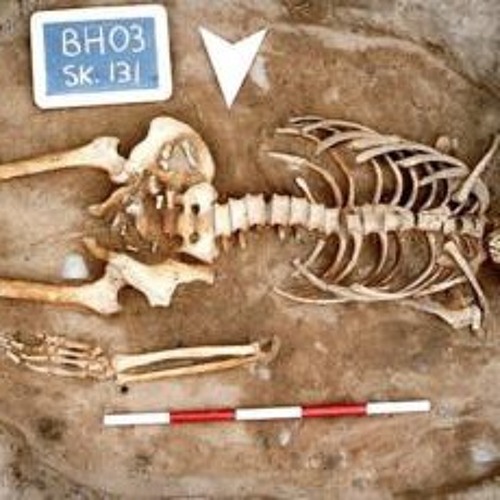 Episode #36: Identifying Skeletal Remains by Authors on the Air Global ...