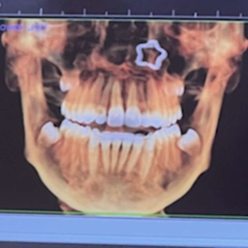 Stream Xcaniz by Luh Twizzy | Listen online for free on SoundCloud