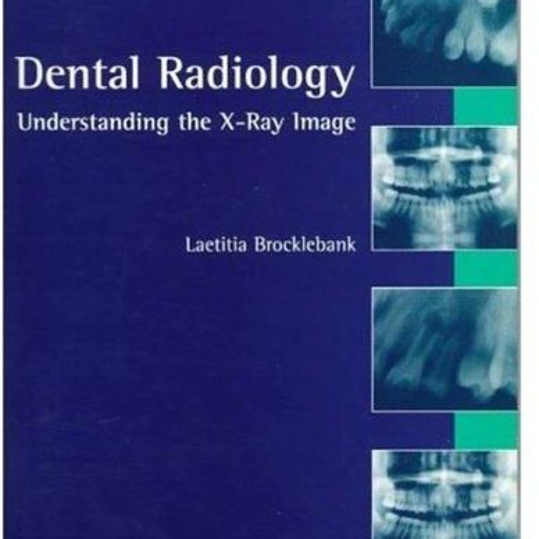 Stream episode PDF Dental Radiology: Understanding the X-Ray Image by ...