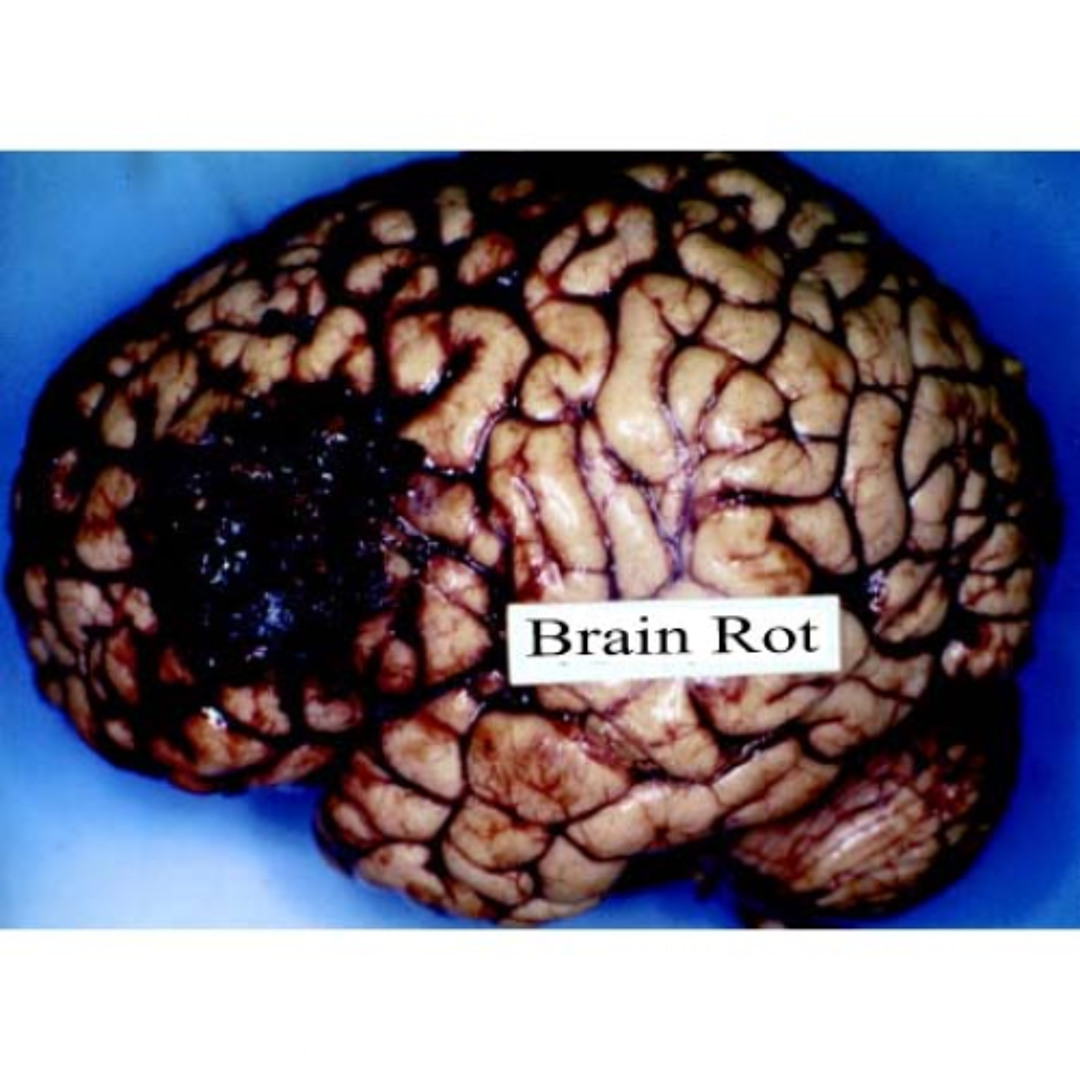 Stream Dead Internet Theory | Listen to Brain Rot playlist online for ...