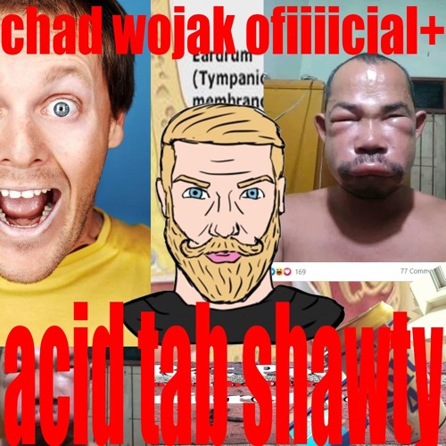 Stream acid tab shordieee by Chad Wojak Official | Listen online for ...
