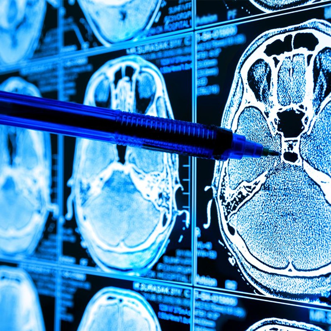 Stream AI in Biomedical Imaging: Transforming Microscopy and ...
