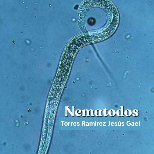 Stream episode Nematodos by Gael Torres podcast | Listen online for ...