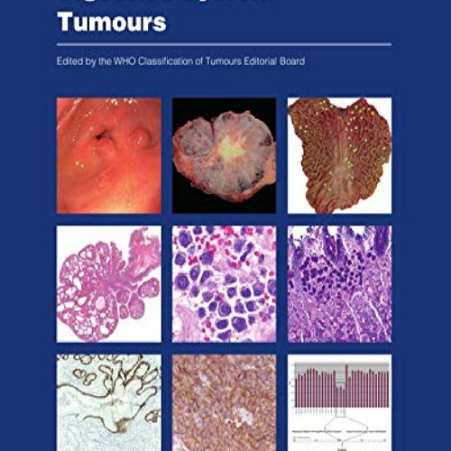 Stream episode Ebook (download)⚡ DEFAULT_SET: Digestive System Tumours ...