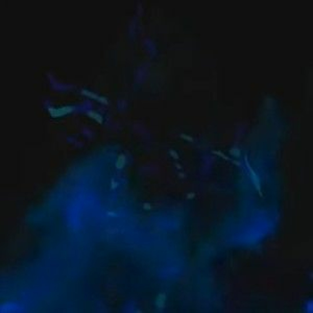 Stream Lament - Stained, Brutal Calamity | Calamity Mod OST by ...