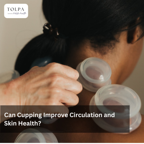 Stream Can Cupping Improve Circulation and Skin Health? by Tolpa ...