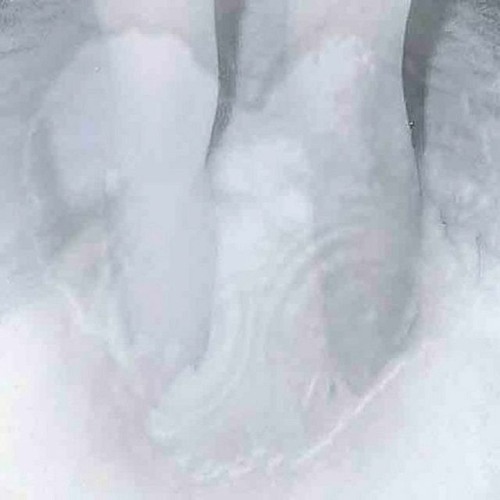 Stream cholorofilm + kidsnorlax - rot, deceased by