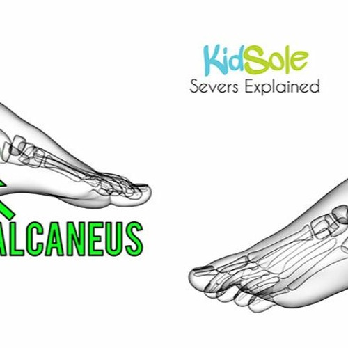Stream 5 Things Parents Need To Know About Severs Disease Shoe Insole ...