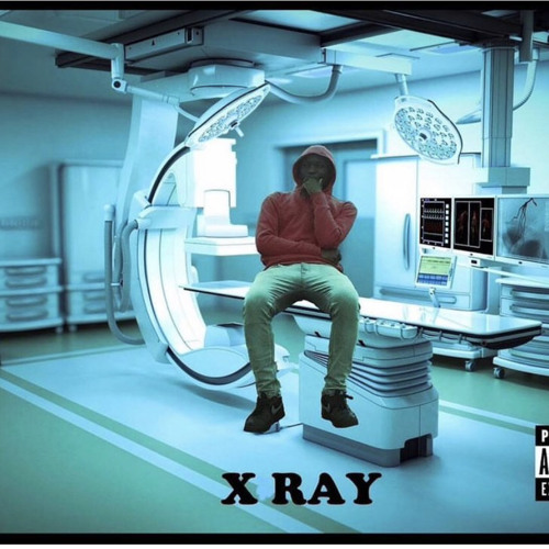 Stream X RAY - Can’t be Checked Full Album ( 20 songs enjoy ) by X RAY ...