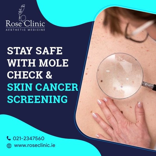 Stream Book A Full - Body Digital Mole Screening In Limerick From Rose ...