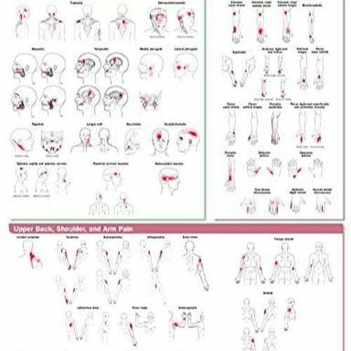 Stream episode Epub Travell, Simons & Simons? Trigger Point Pain ...