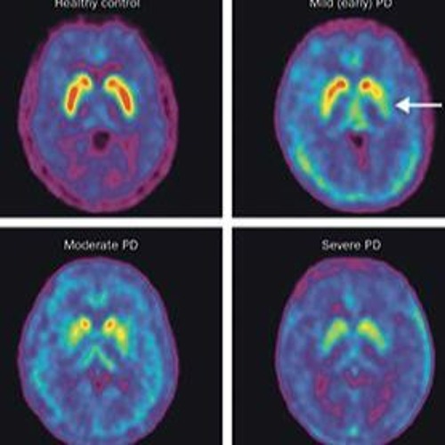 Stream Dopamine Chaser 2nd Half by Barnstormer | Listen online for free ...