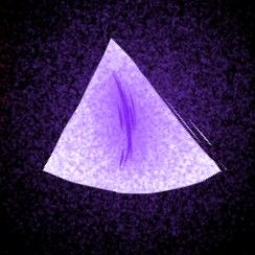 Stream Aidos Listen To Pidor Playlist Online For Free On Soundcloud