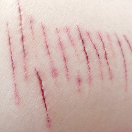 Real Arm Cut Bleeding