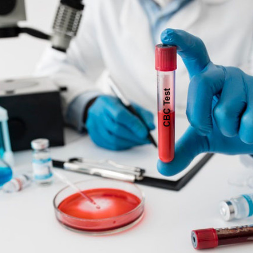 Stream Understanding CBC Test Prices in Chandigarh A Comprehensive ...