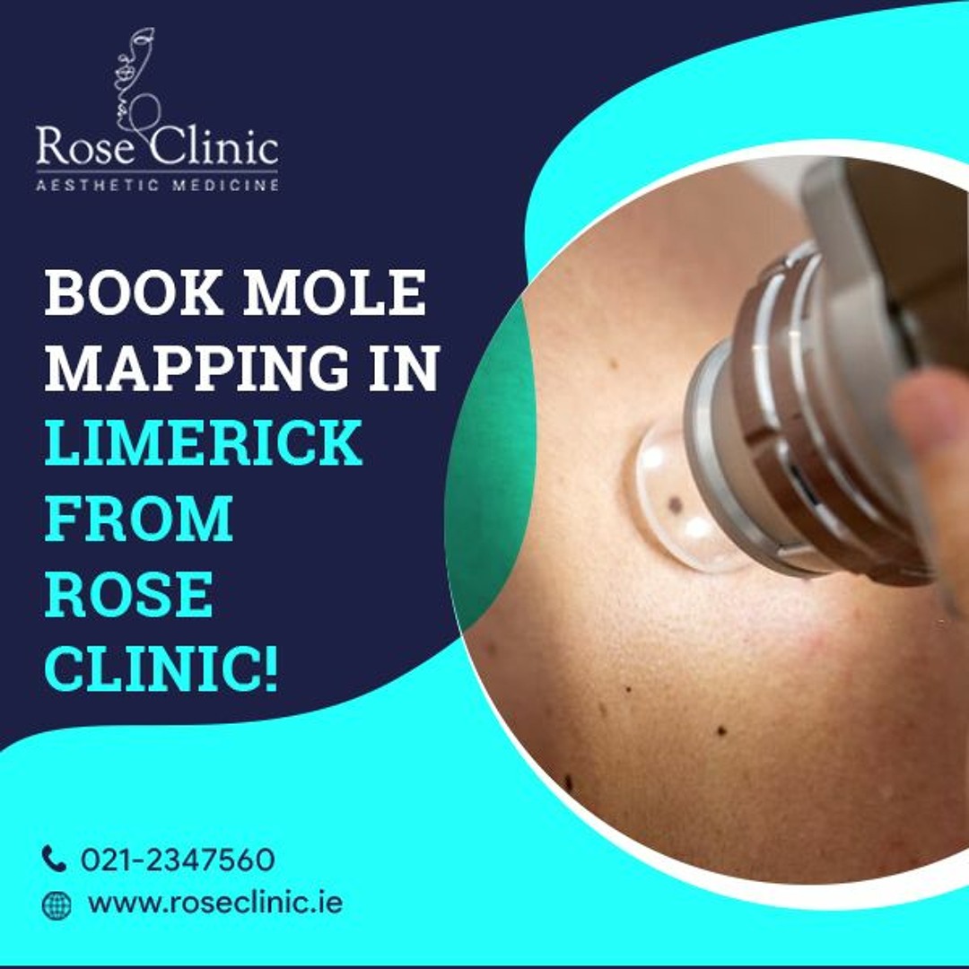 Stream The Rose Clinic Brings Digital Mole Mapping In Limerick To ...