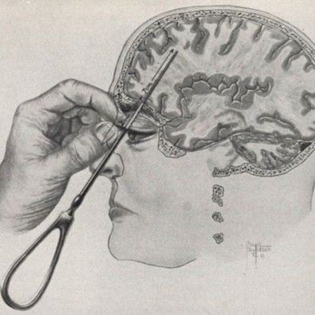 Stream LOBOTOMIA EP1 by Lobotomia | Listen online for free on SoundCloud