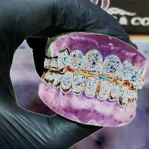 Stream Aadm Our Hatley - Bozo Teeth (The Blue Lady's Diamond Grill ...