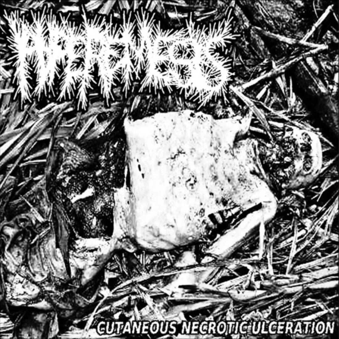 Stream Hyperemesis - Cutaneous Necrotic Ulceration by abe | Listen ...