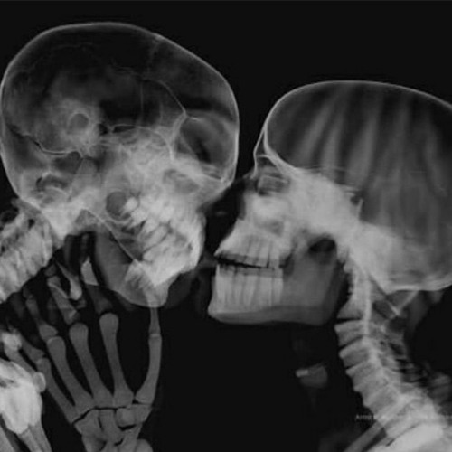 X Ray Skeleton Kiss
