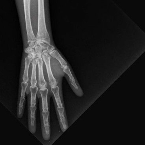 Stream Electro cut by Factory Reset | Listen online for free on SoundCloud