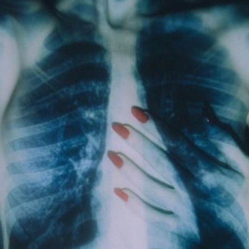 Stream Boyfriend In A Coma by Vampires Reflection by Flurry Kunz ...