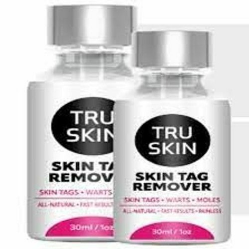 Stream Tru Skin Tag Remover Review [Scam Alerts?] Is It Fake Or Trusted ...