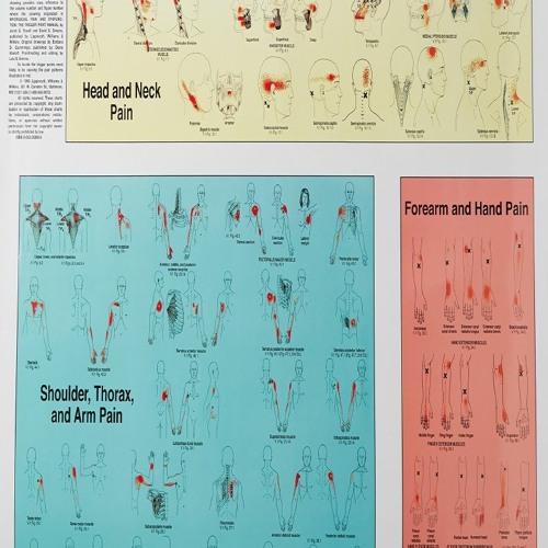Stream [EBOOK]⚡ Trigger Points of Pain: Wall Charts (Set of 2) from ...
