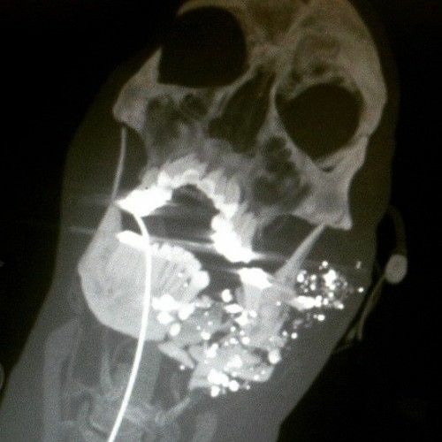 Stream LETS ROLL by RudeBoi$lick | Listen online for free on SoundCloud