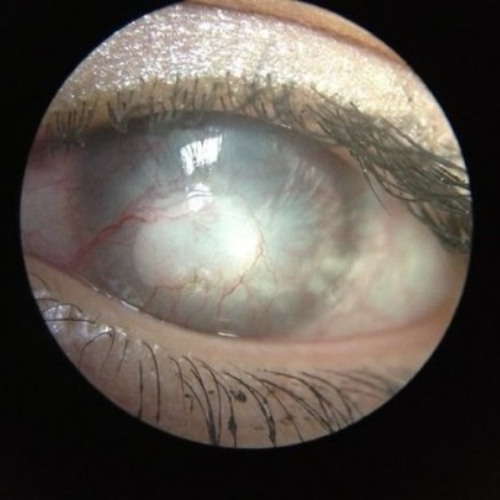 Stream BREATHE THE EUPHORIA (FIRE ON LVPL STREET MIX) by KAVARI ...