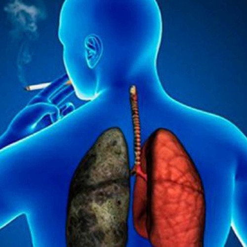 Stream Carlitos Vera Type Beat by YUNG YISA | Listen online for free on ...