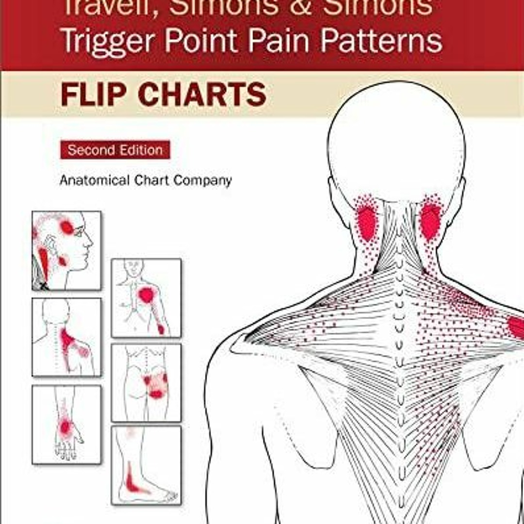 Stream episode Free read Travell, Simons & Simons? Trigger Point Pain ...