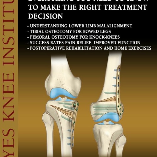 Stream PDF BOOK Bowed Leg (Varus) and Knock-Knee (Valgus) Malalignment ...