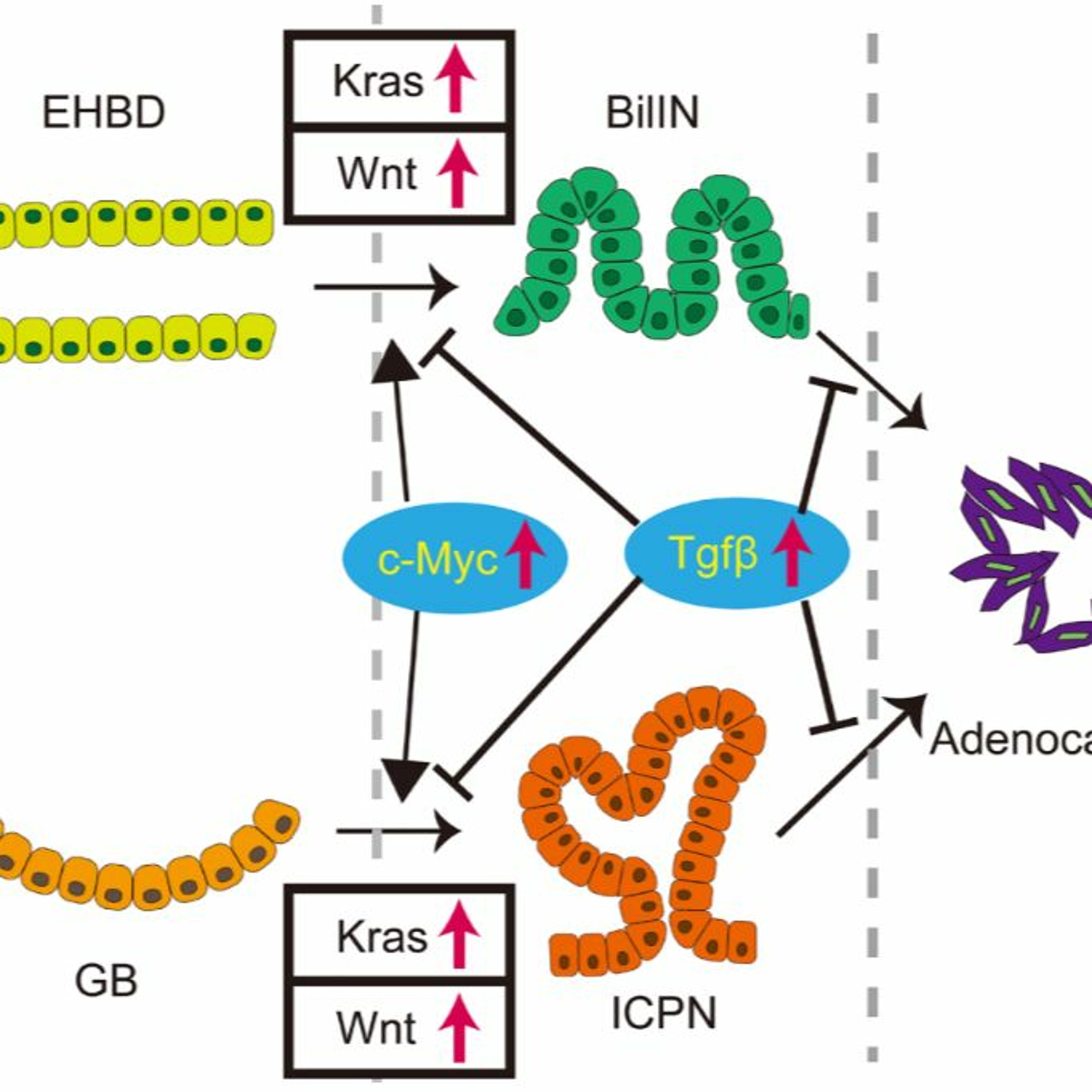 The Role of Kras and Canonical Wnt Pathways in Biliary Tract Cancers ...