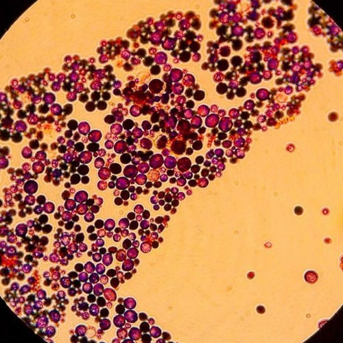 Stream episode Infecciones producidas por hongos by Candy Herrera ...