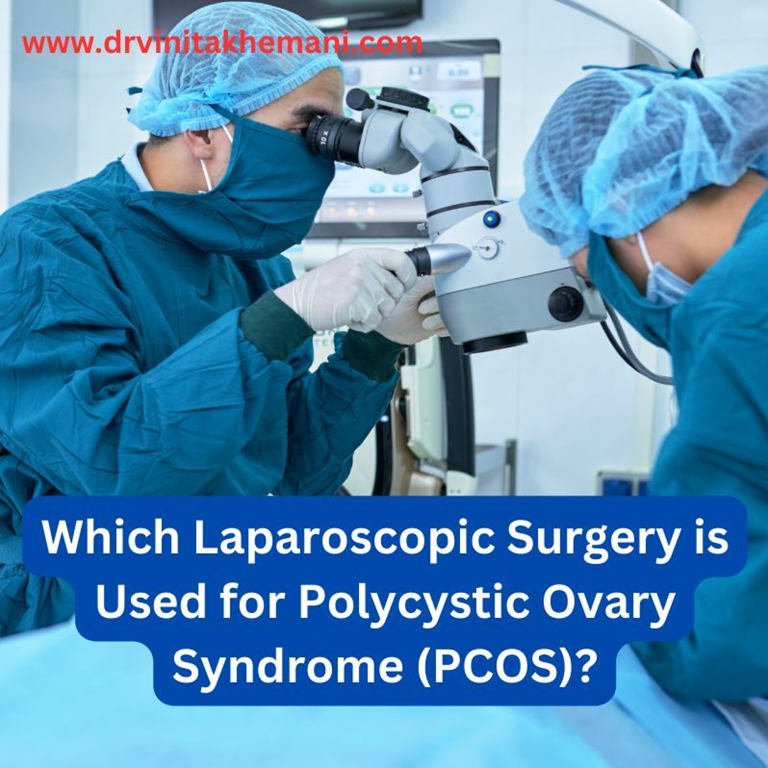 Stream Which Laparoscopic Surgery is Used for Polycystic Ovary Syndrome ...