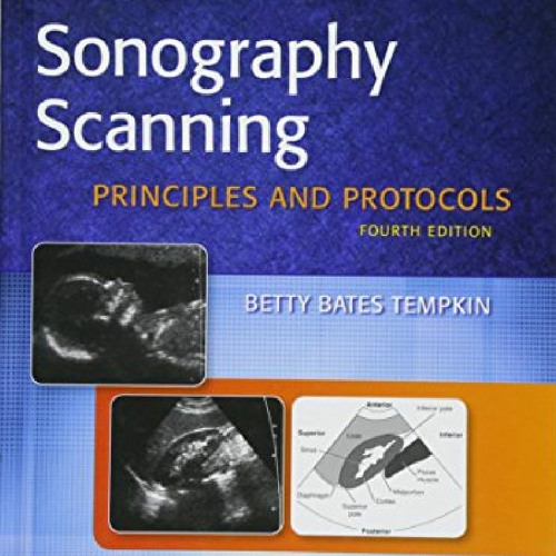 Stream PDF READ Sonography Scanning: Principles and Protocols (Ultrasound Scanning) from ...